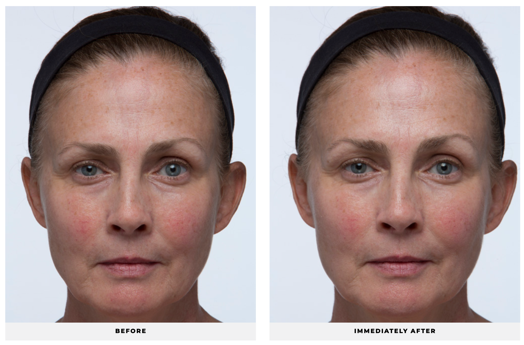 Ultra Replenishing Sunscreen SPF 40 – Cosmedical